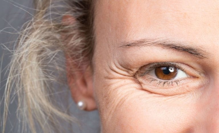 Forehead Lines Treatment Norwich | The Doctors Laser Clinic
